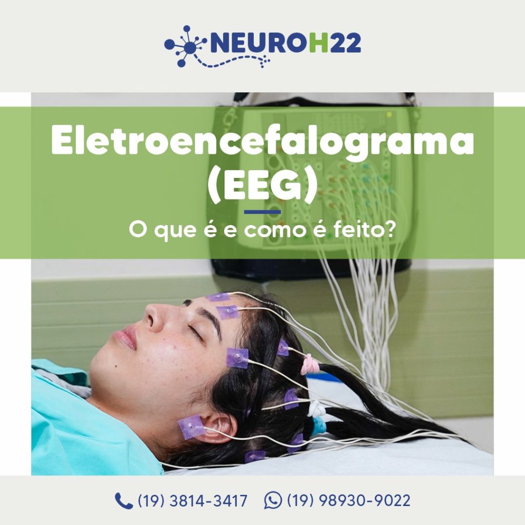 O que é e como é feito o Eletroencefalograma (EEG) - NEUROH22